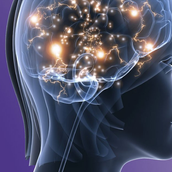 Brain scans | Epilepsy Society