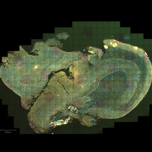 Sudden Unexpected Death in Epilepsy (SUDEP) | Epilepsy Society